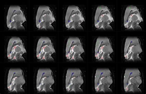 Multi Tissue Csd Preprocessing Mrtrix3 Community
