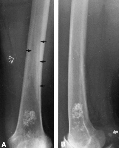 Normal Anatomic Variants And Miscellaneous Skeletal Anomalies