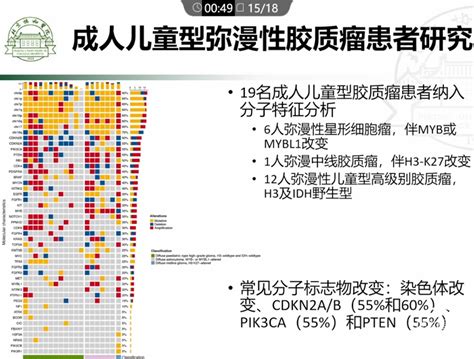 陈雯琳住院医师：基于2021年who中枢神经系统肿瘤分类下成人儿童型弥漫性胶质瘤患者的单中心描述性研究 脑医汇